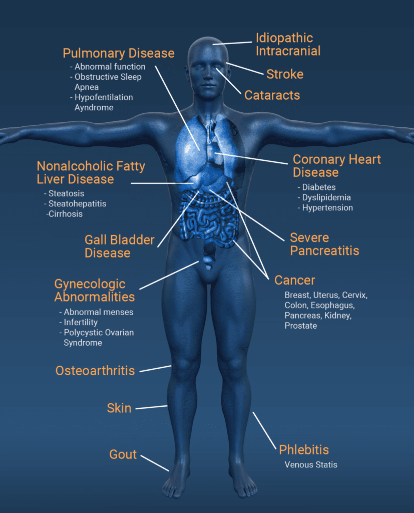 Weight Management - Advanced Institute for Diabetes & Endocrinology